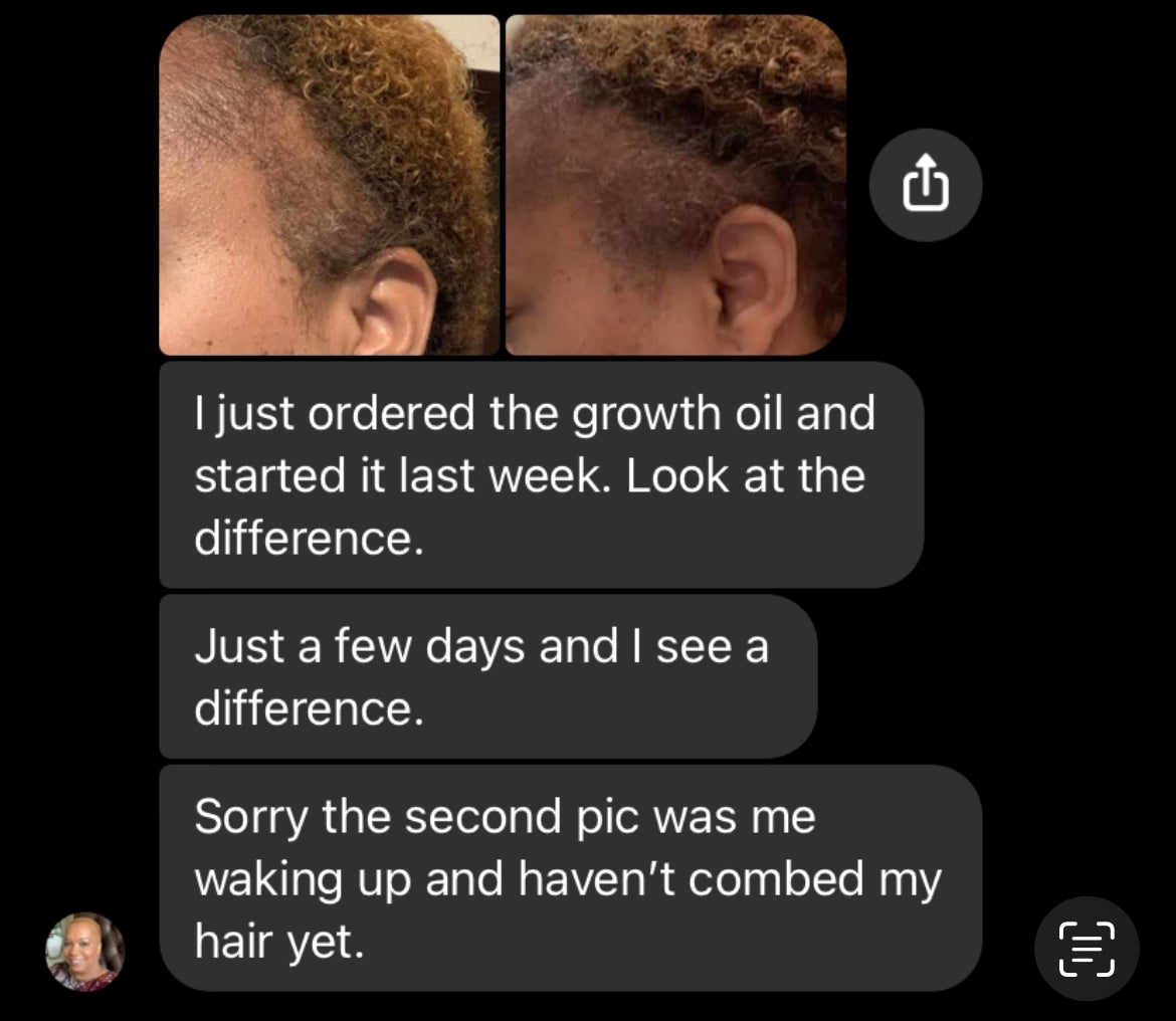 Locs – Tree Naturals